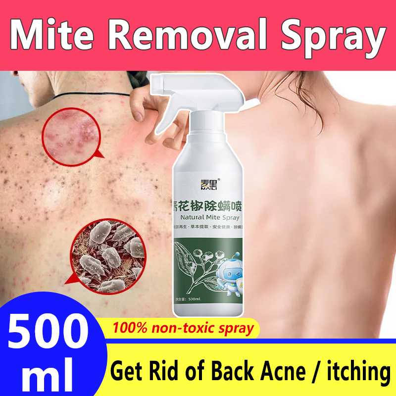 500ML Bed Bug and Dust Mite Removal Spray and Flea Spray Reduce Skin ...