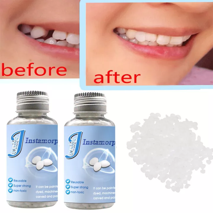 Denture Adhesive Glue Repair Denture Missing False Teeth Solid Glue ...