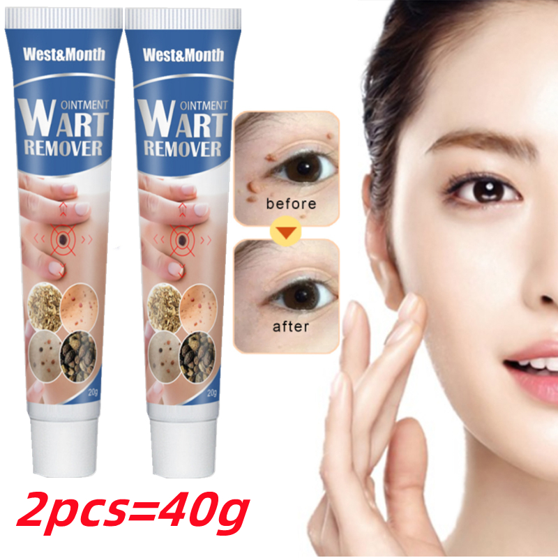 【BUY 1 TAKE 1】Painless wart remover ointment 20g Anti wart removal ...