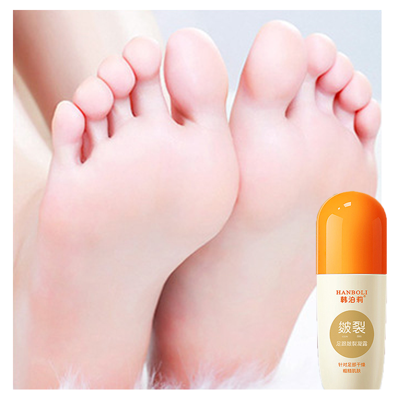 Original Foot Cream For Dry and Crack Heels Repairing Rough Calluses ...