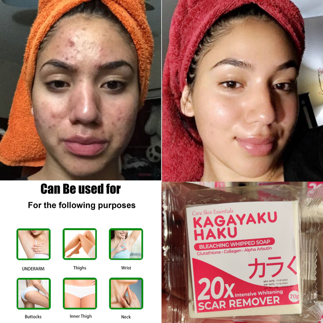 AFFORDABLE KAGAYAKU SOAP Whitening Round Bar Beauty Soap LEGIT NA SABON ...