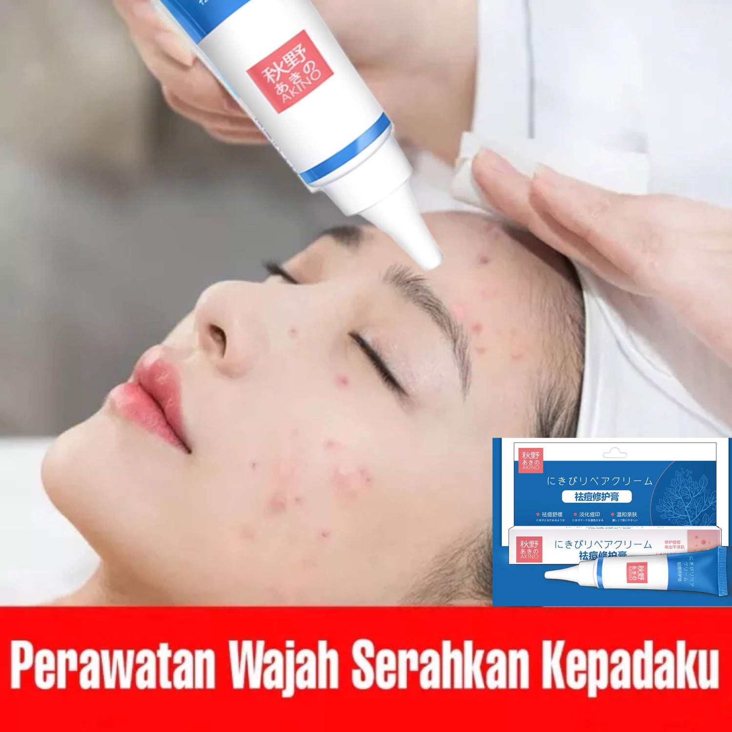 Remove Pimples Quickly Acne gel scar remover Pimple Remover Acne Cream ...