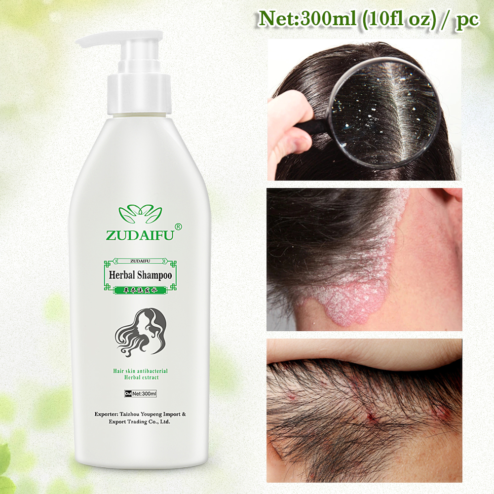 100% Original ZUDAIFU Shampoo Anti-dandruff 300ml Oily Scalp ...
