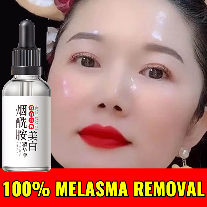 Whitening Freckle Serum Anti-Freckle Essence melasma and pekas remover ...