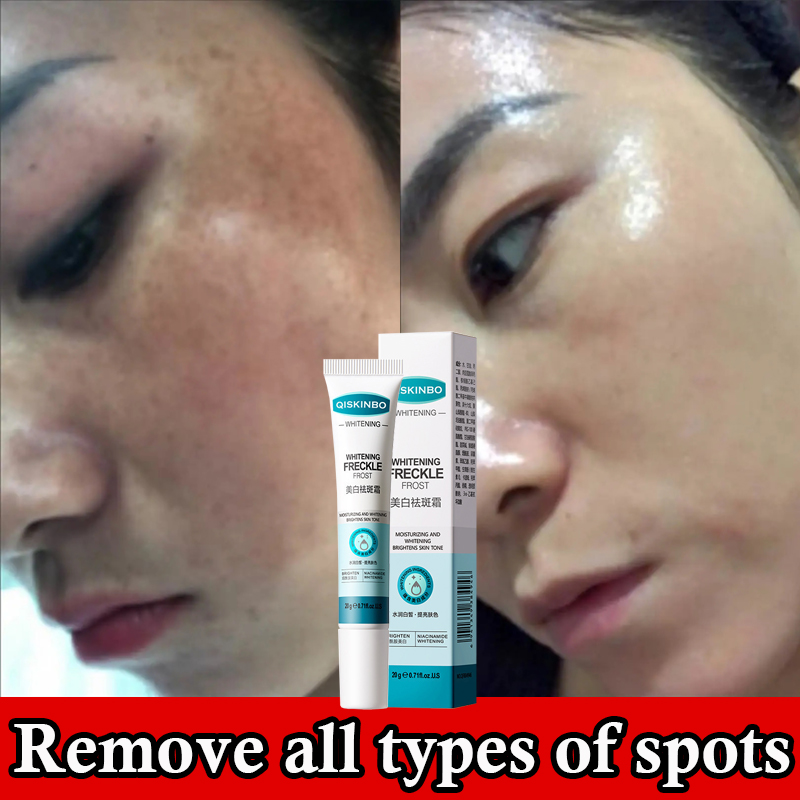 Whitening Freckle Cream Removal Melasma Anti Aging Serum Remover Cream ...