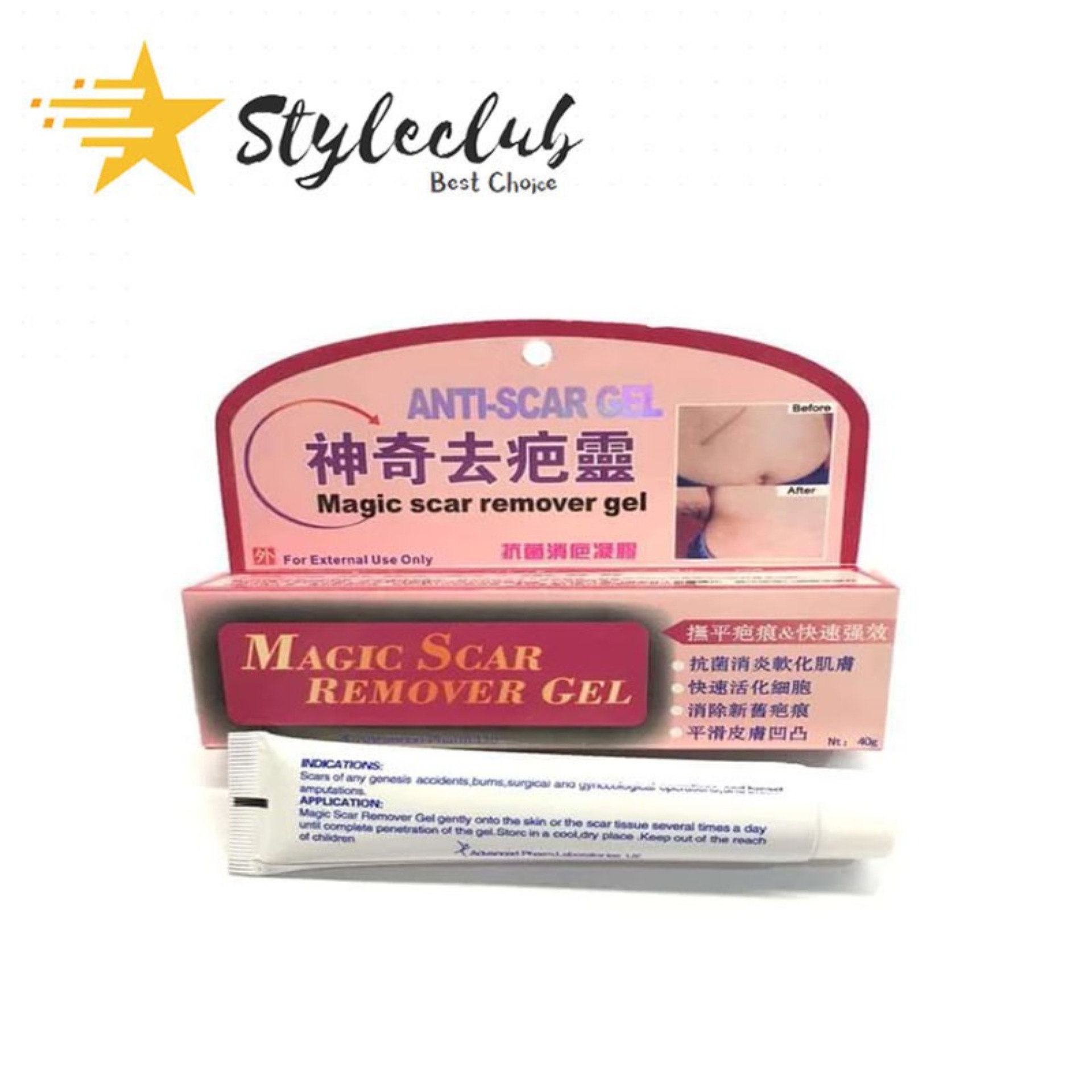 STYLECLUB Magic Scar Remover Gel 40g | Lazada PH