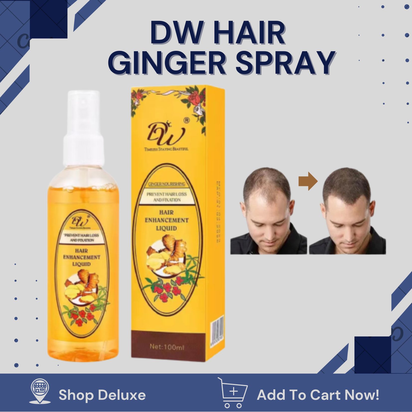 DW Ginger Hair Enhancement Liquid Spray Hair Growth 100ml | Lazada PH