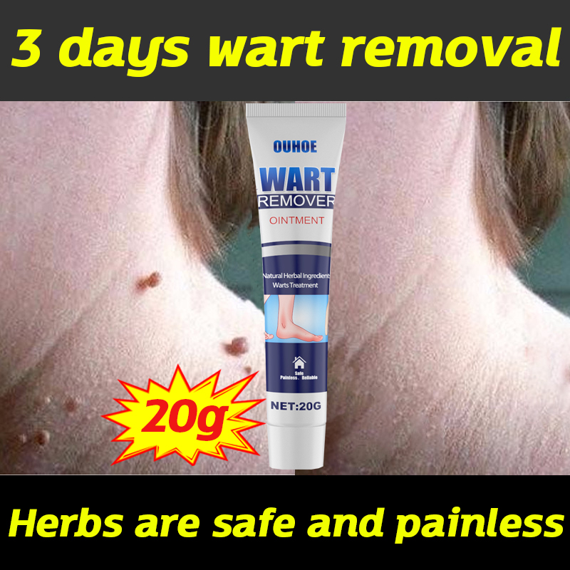 💖Painless remove warts💖 Wart Remover Ointment 20g Wart Treatment Cream ...