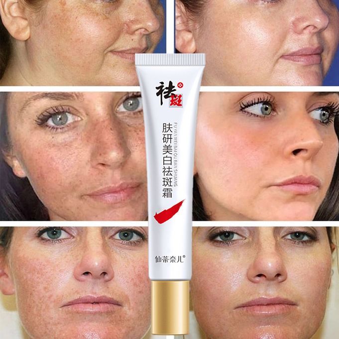 FELICE🔥 20g Whitening Freckle Removing Cream Moisturizing Repairing ...