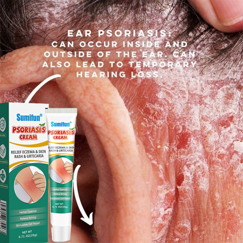 🔥100% Effective🔥Herbal Psoriasis Eczema antibacterial cream Safe Plant ...