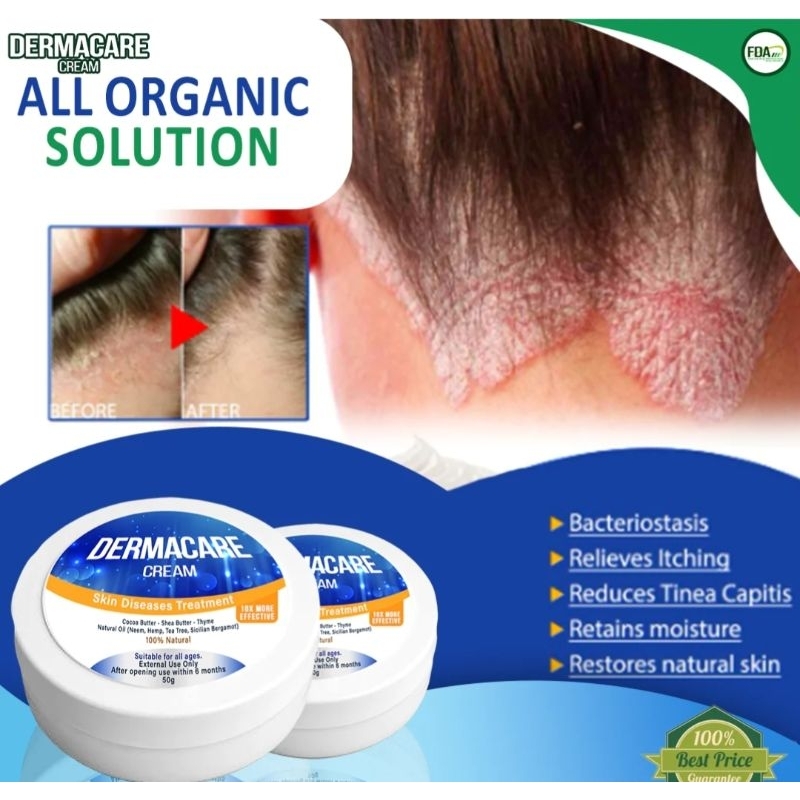 DERMACARE CREAM - Treatments for Eczema | Lazada PH