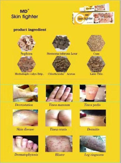 LOVE HOME 35g Original MD Skin Fighter Cream for Skin Allergies or ...