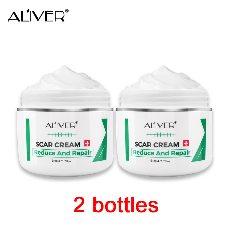 ALIVER scar remover for old scar on leg 50ml ,Peklat Remover Cream ...