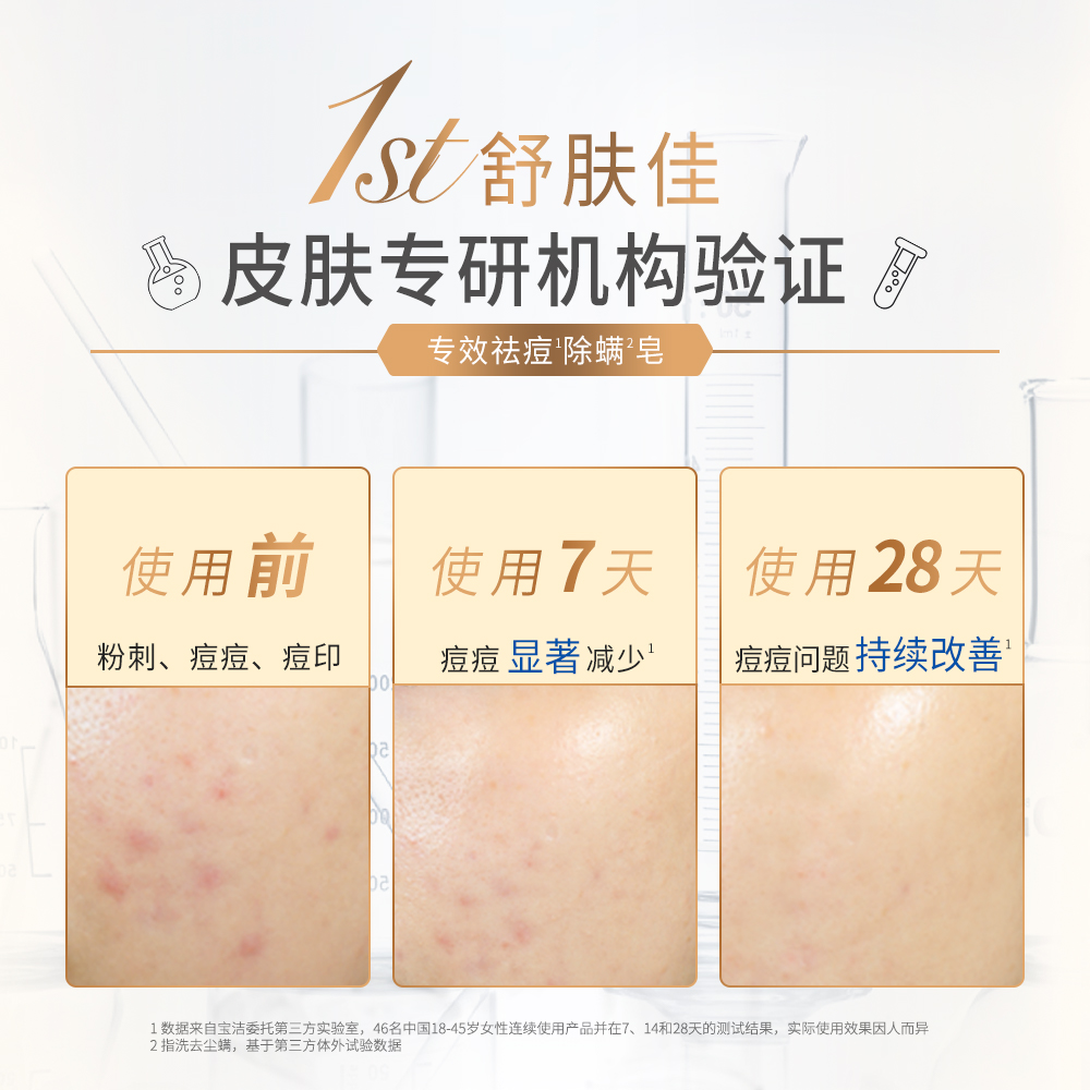 Safeguard Soap Acarus Killing Acne Removing Refreshing White Tea ...