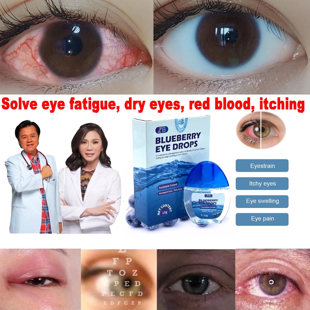 Blueberry Eye Drops | Itchy Eyes | Glaucoma | Eye Drops | Dry Eyes ...