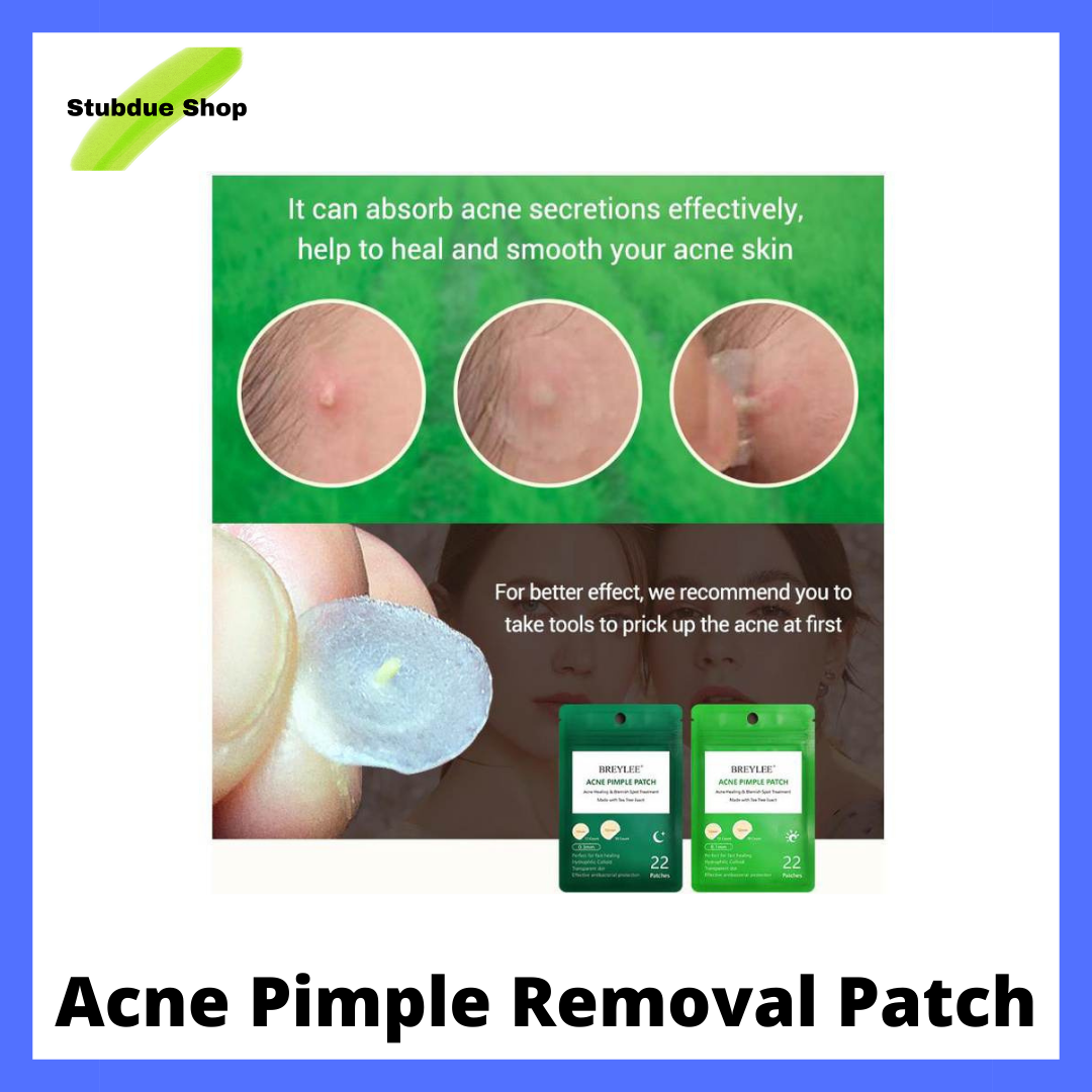 Acne Pimple Patch | Lazada PH