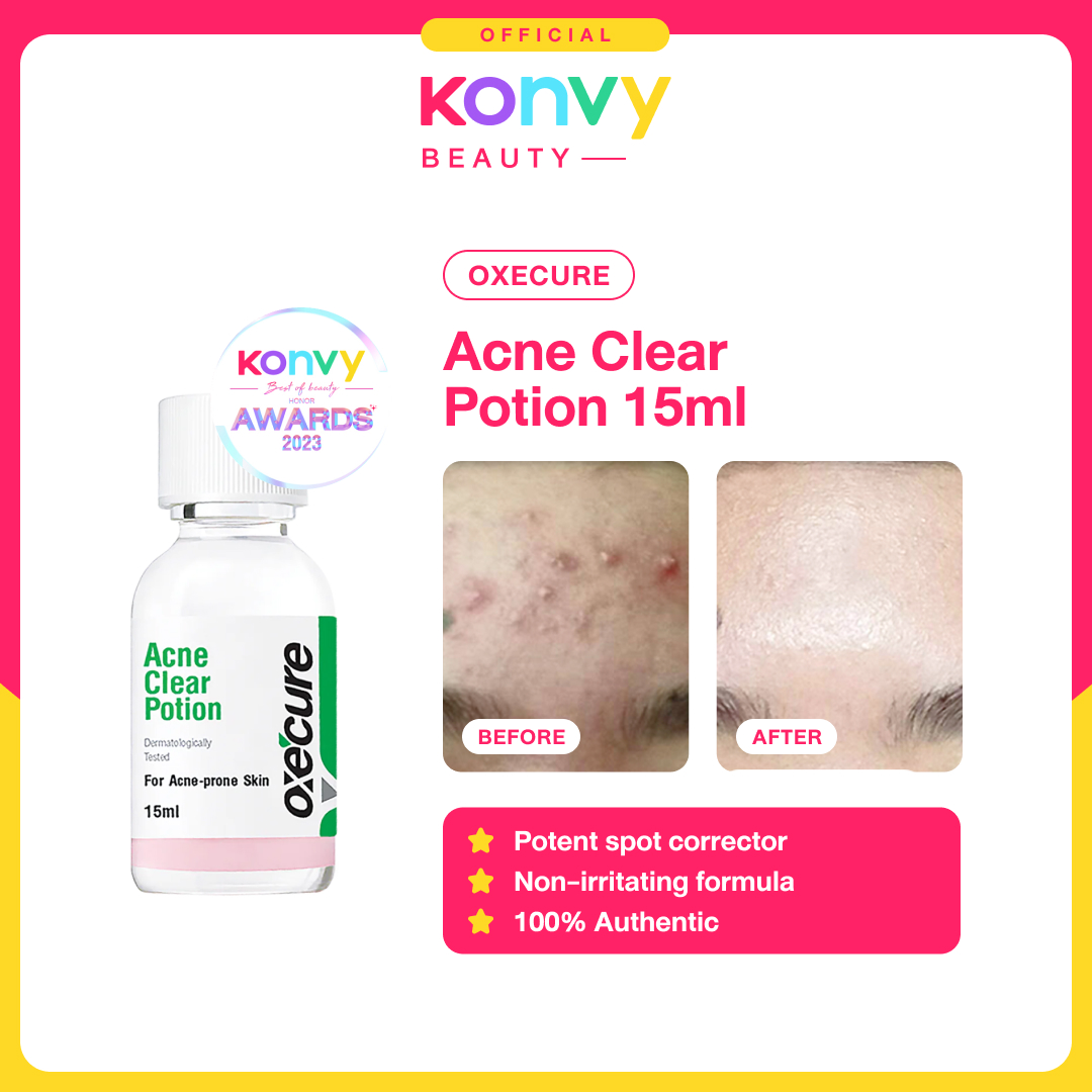 OxeCure Acne Clear Potion 15ml (For Acne-Prone Skin; Pimples ...