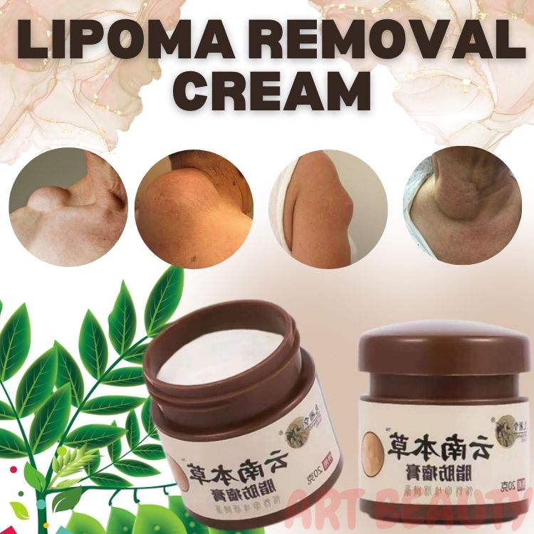 Lipoma Removal Cream Treat Tumor Skin Swelling Ointment Herbal Original ...