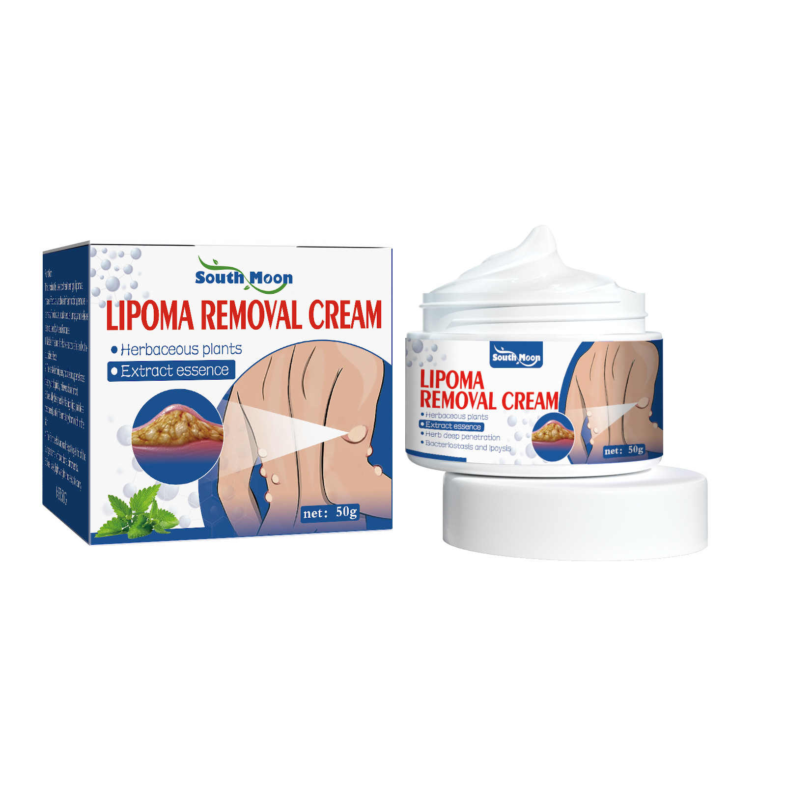 【South Moon】 Lipoma Removal Cream lipoma cream Lipoma Removal Ointment ...