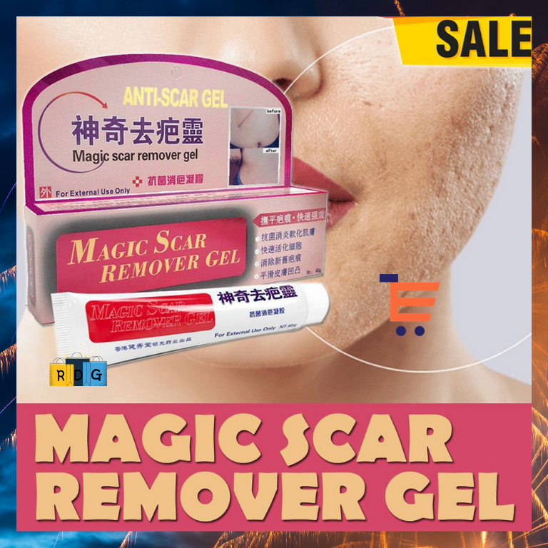 E-STORE Authentic Magic Scar Remover Gel Anti-Scar 40g Peklat | Lazada PH