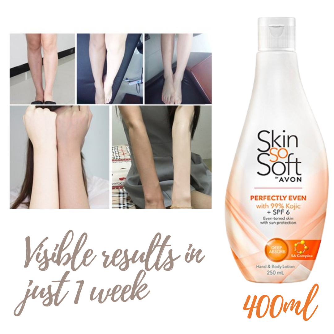 Avon Skin So Soft Kojic Hand & Body Lotion 400 ml GodsFavorBoutique ...