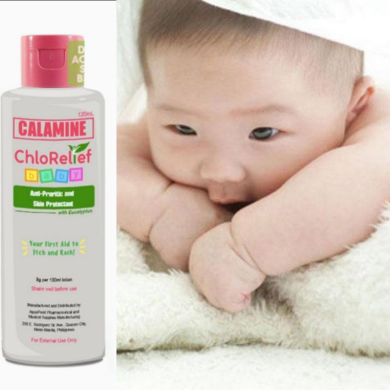 Baby & Kids Anti-Itch and Anti-Rash Lotion 120ml | Lazada PH