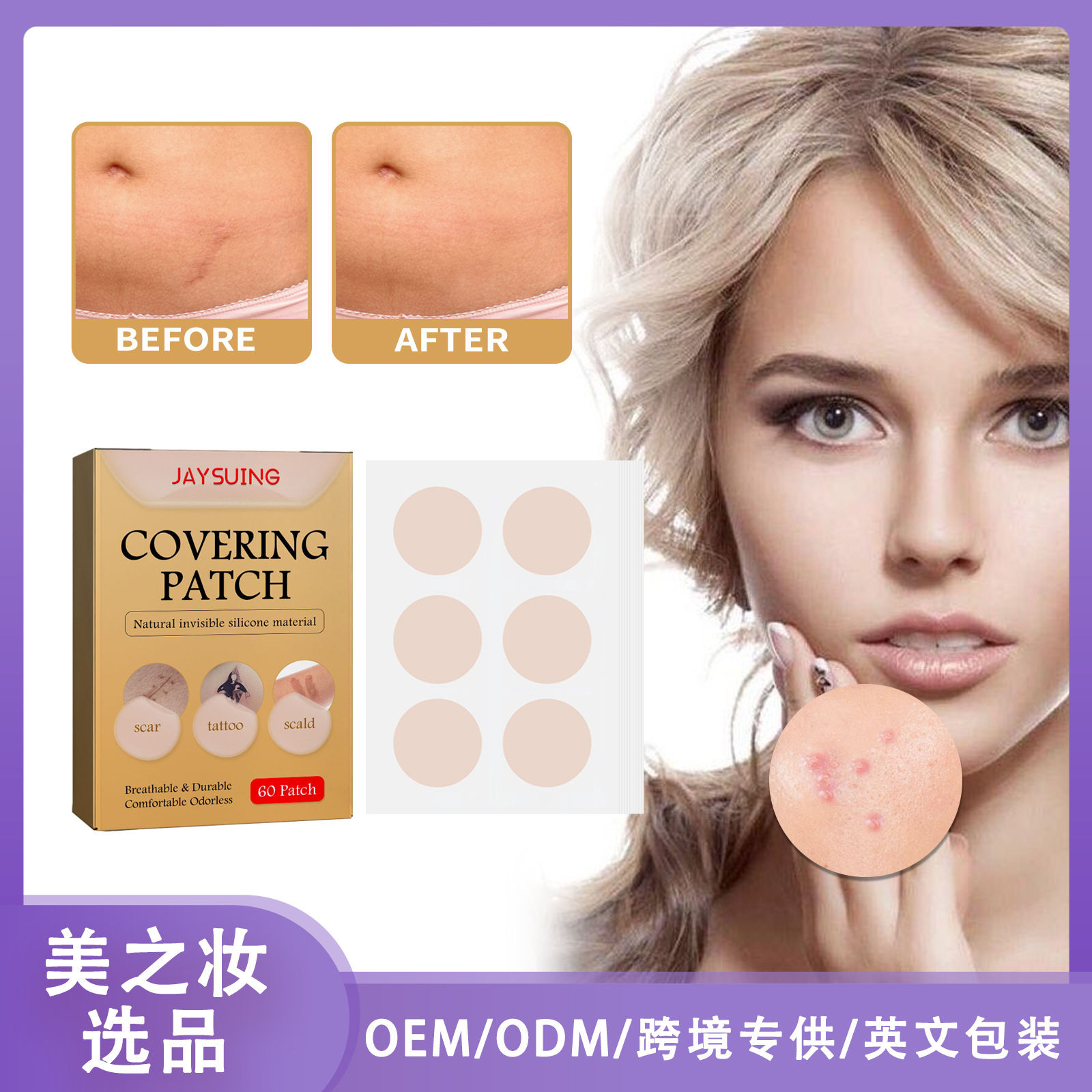 Skin Invisible Concealer Patch Skin Scar Tattoo Acne Mark Cover Patch ...
