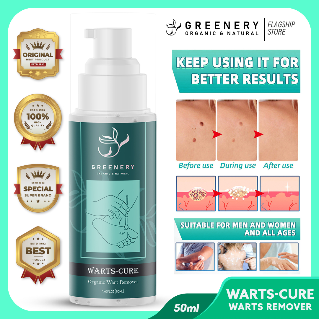 Greenery Wartz Remover【Effective in 7 days】Warts Remover Original Cream ...