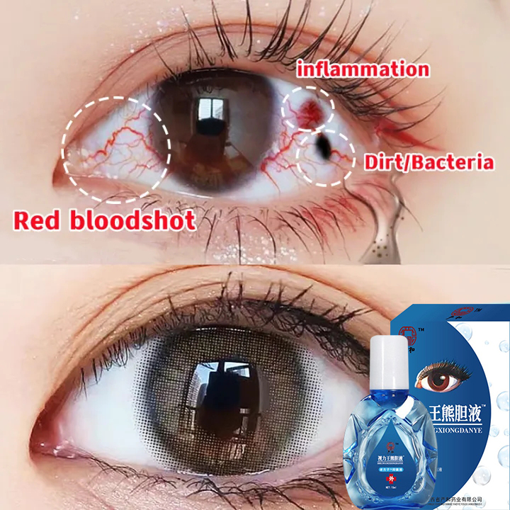 Eye drops original Eyedrops eye drops for clear vision original ...