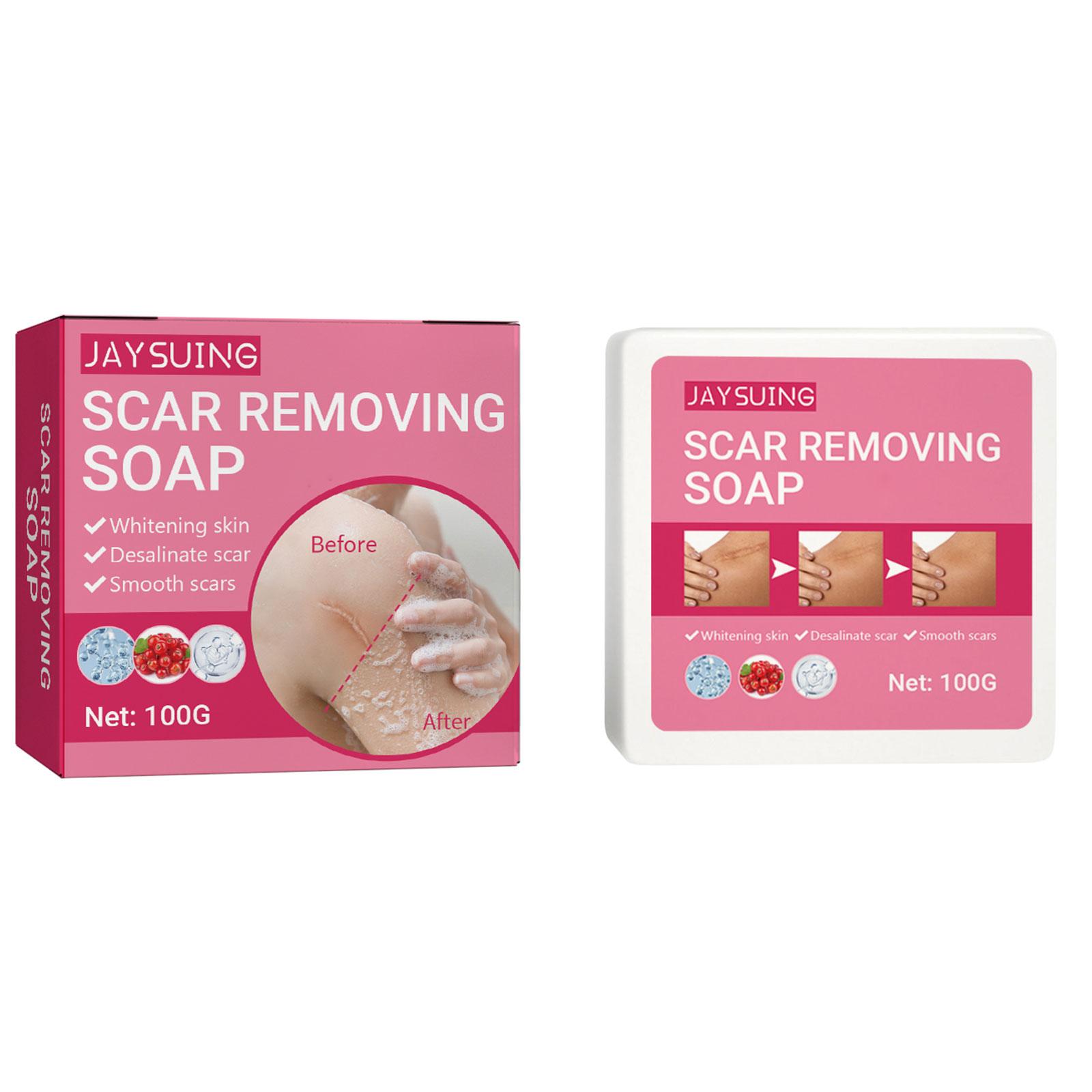 Marks Removal Handmade Soap Body Buttock Breast Mark Scar Stretch ...