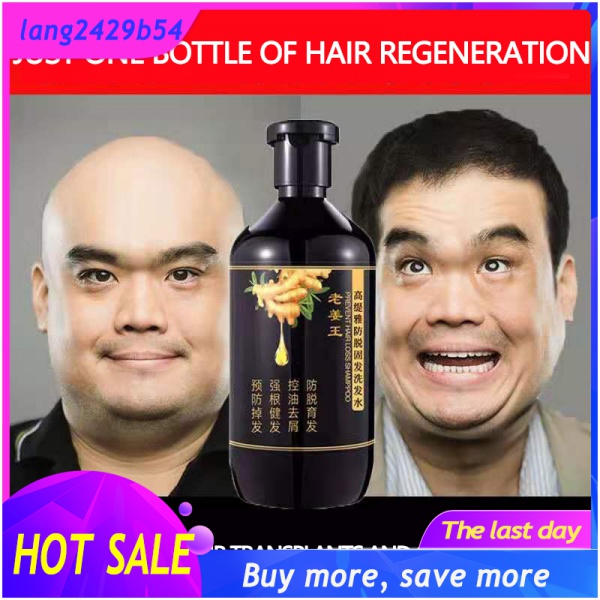 【Hot】Gao Tiya Ginger King Ginger Shampoo Natural Ginger Shampoo for ...