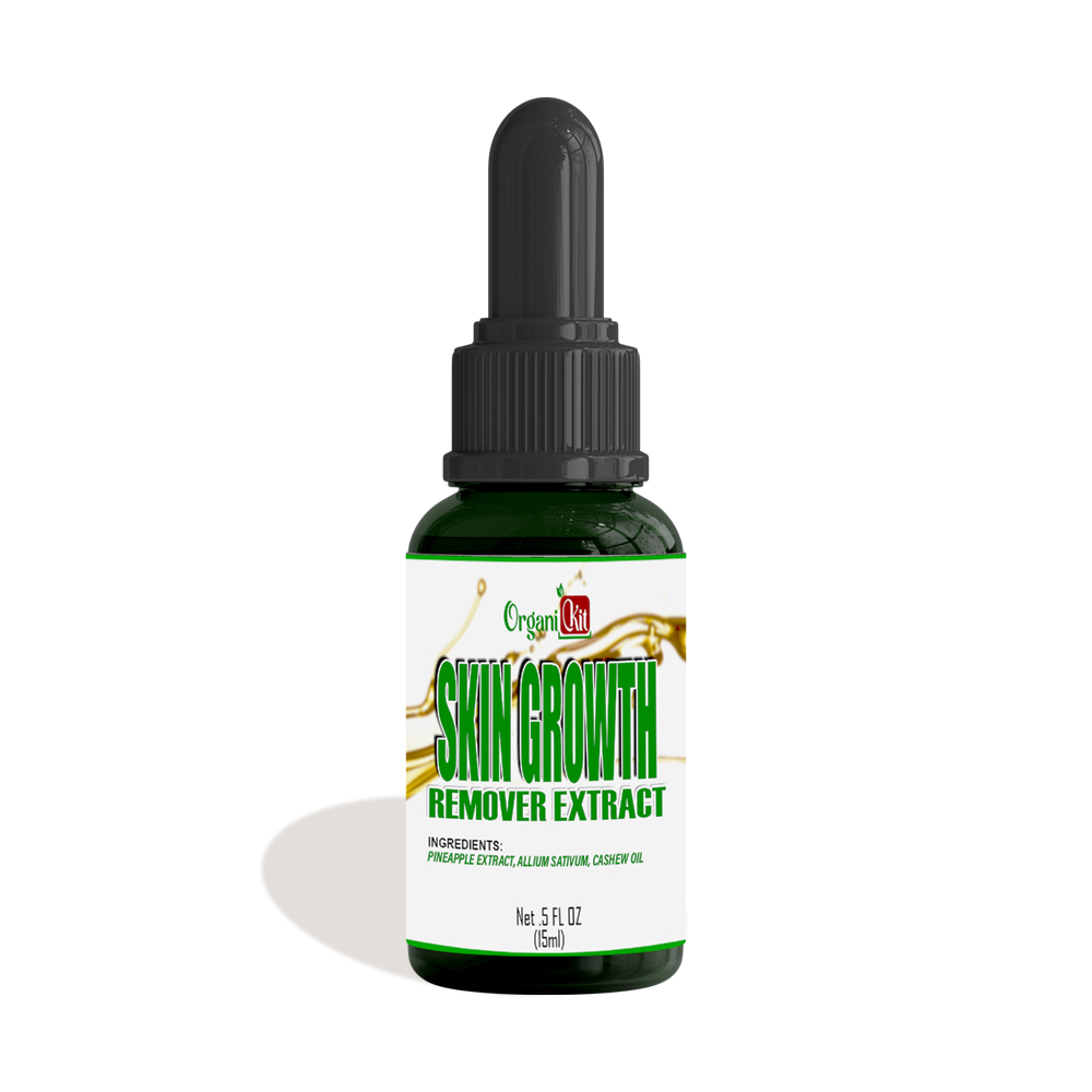 KULUGO PROBLEM?? 100% SURE EFFECTIVE! Skin Growth / mabisang ...