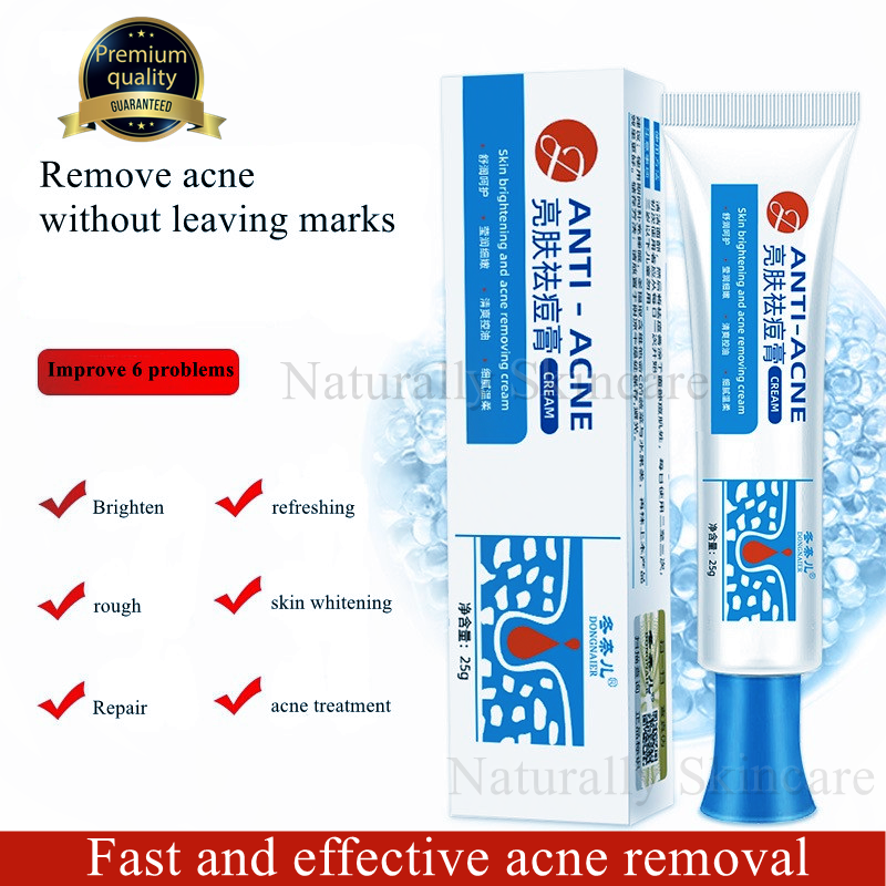 100% Effective Remove Pimples Quickly Pimple Remover Acne Cream Fades Acne Marks Repairs Acne ...