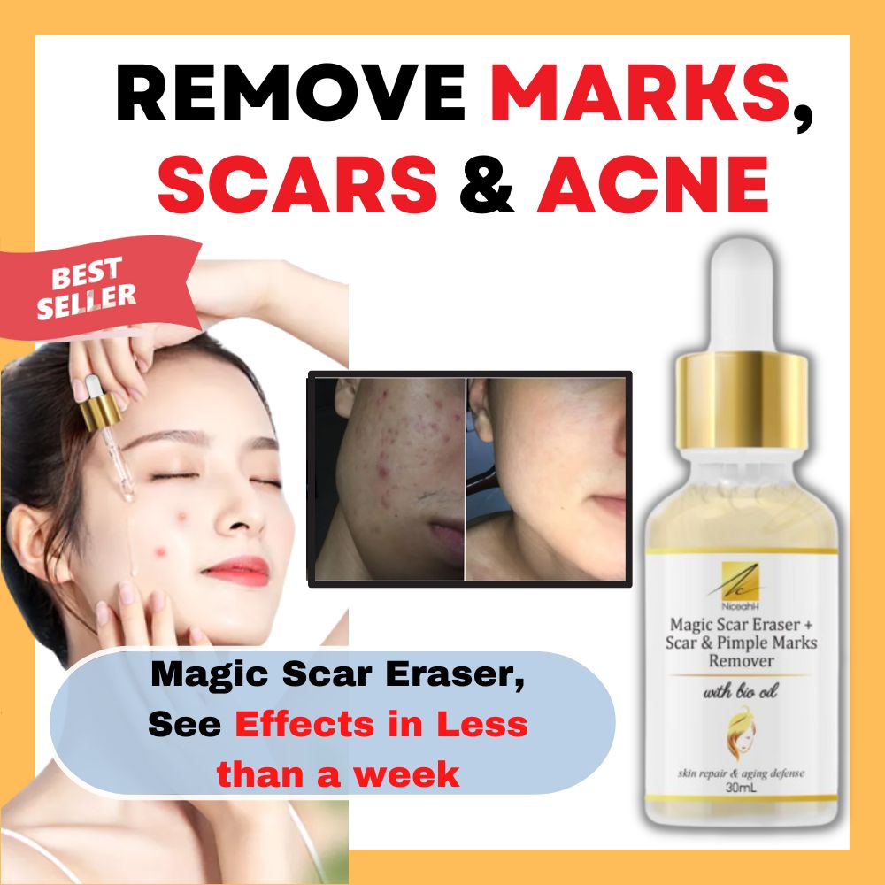 Niceahh Magic Scar Eraser | Scar & Pimple Marks Remover | pantanggal ...