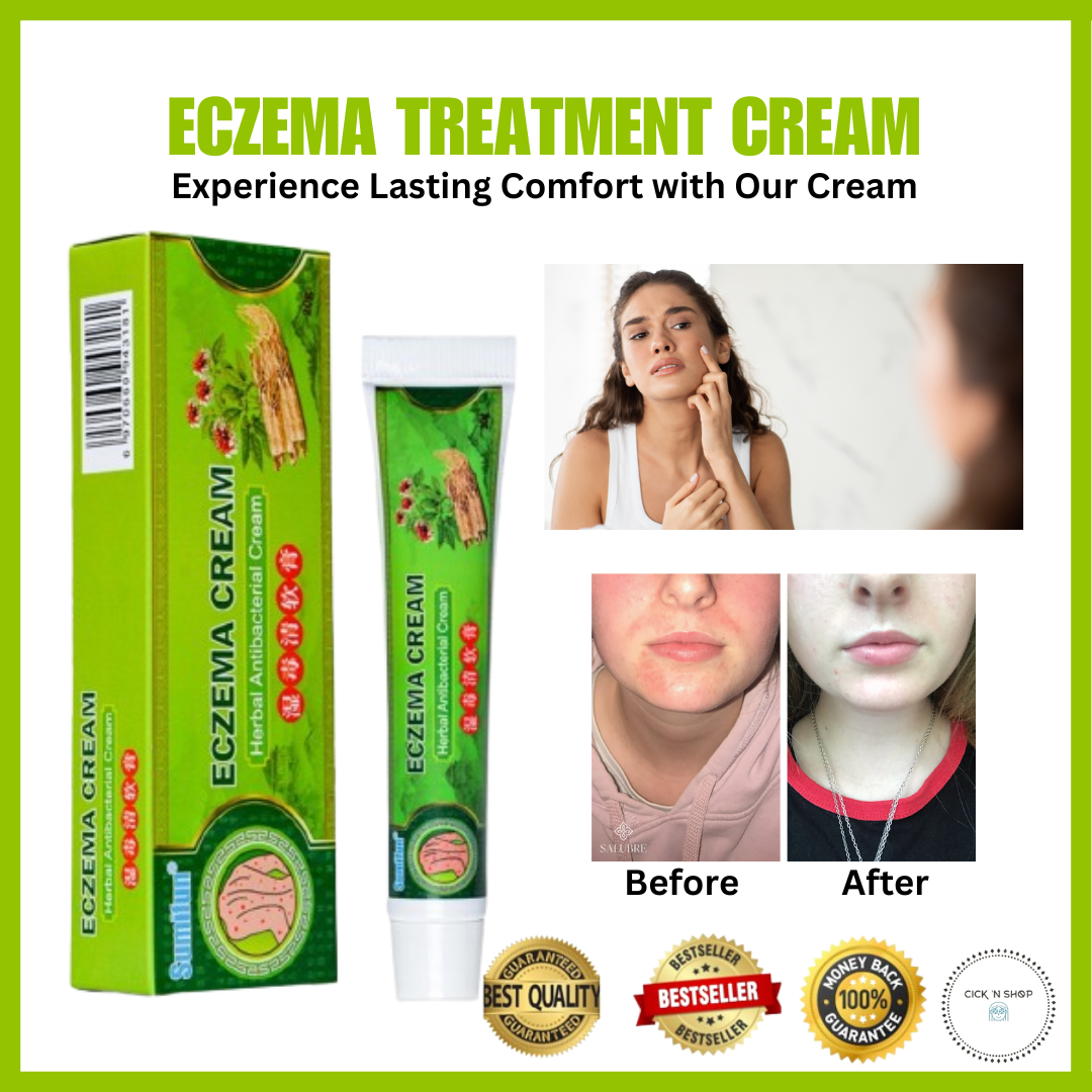 Eczema Treatment Cream Eczema Psoriasis Allergy Antibacterial Skin ...