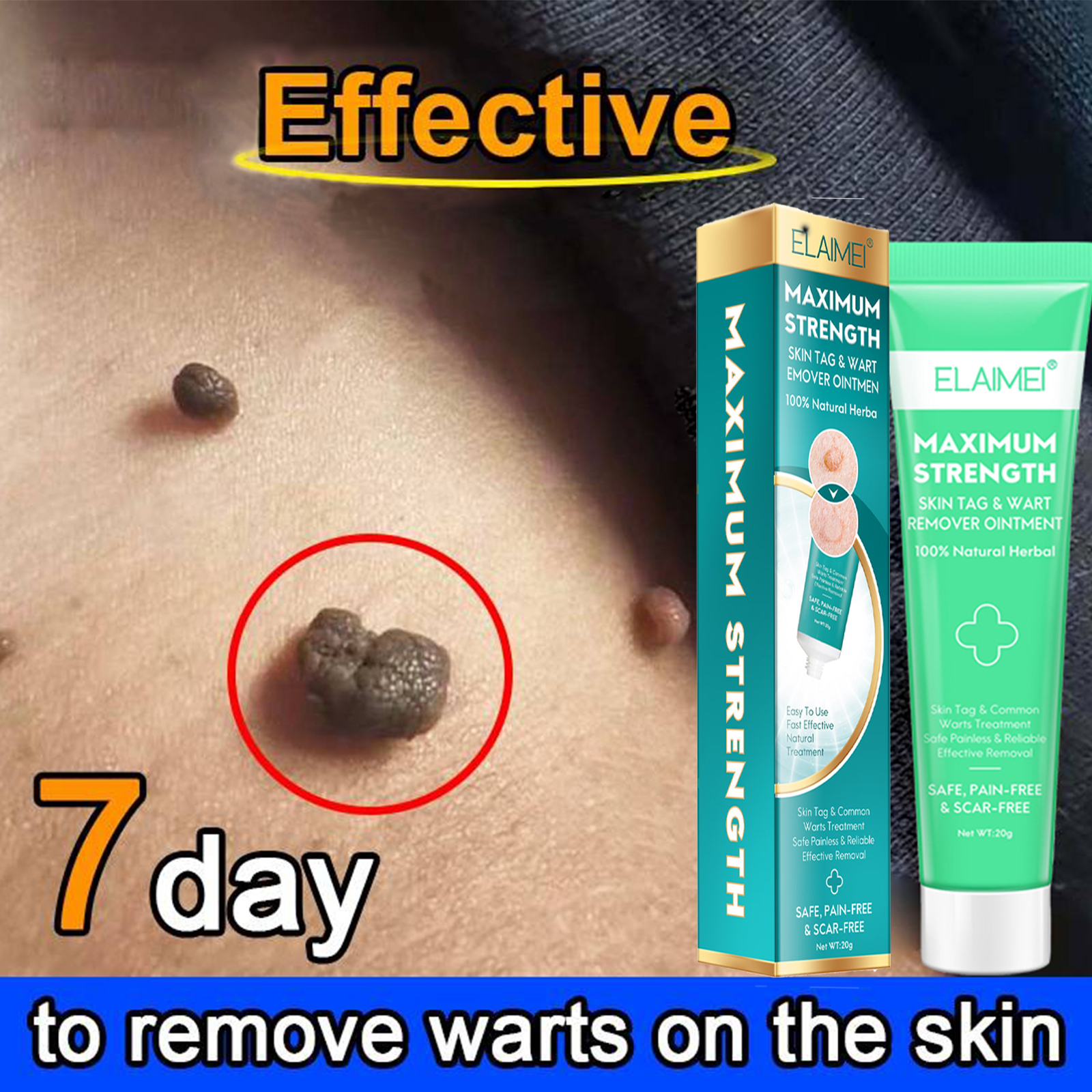 【Fast and Painless】ELAIMEI Warts remover original Skin tags remover ...