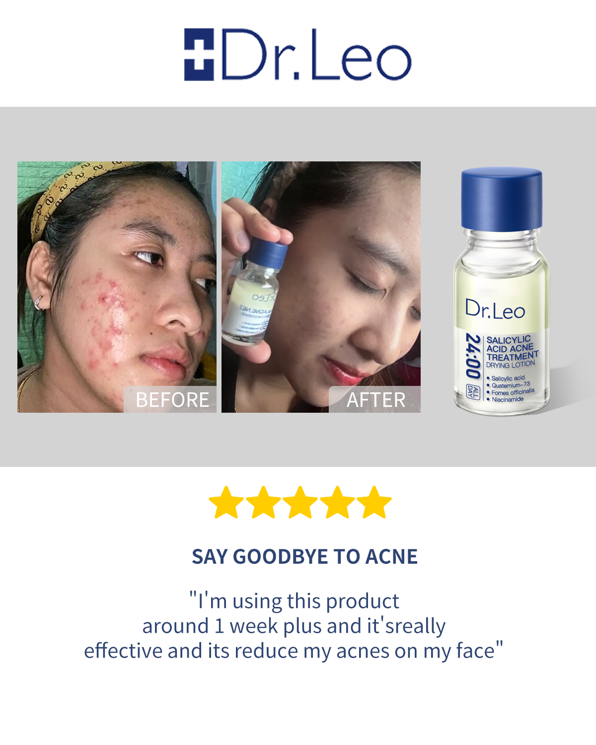 Dr.Leo Store Philippines Official Online Store | Shop Now on Lazada